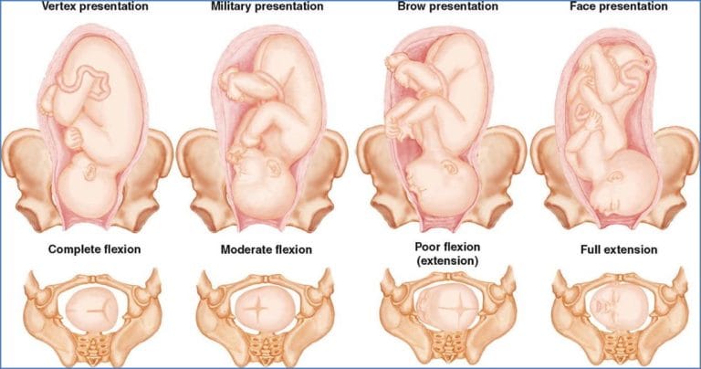 Normal Labour and Delivery | Obstetrics | MedStudentNotes