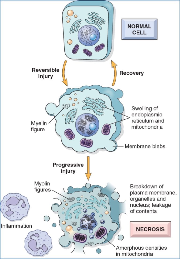 Cell Injury and Death | Cell Biology | MedStudentNotes